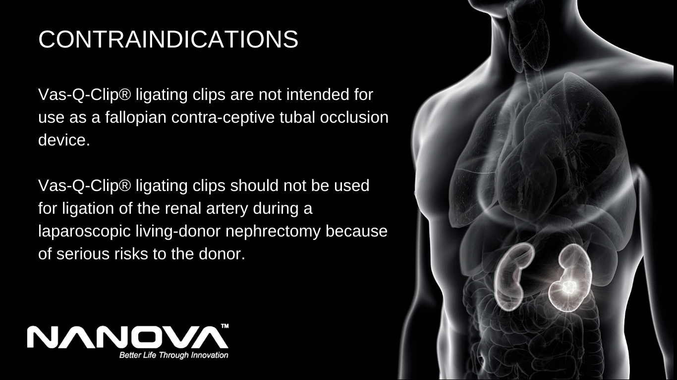 Clinical Benefits | Vas-Q-Clip® Surgical Application
