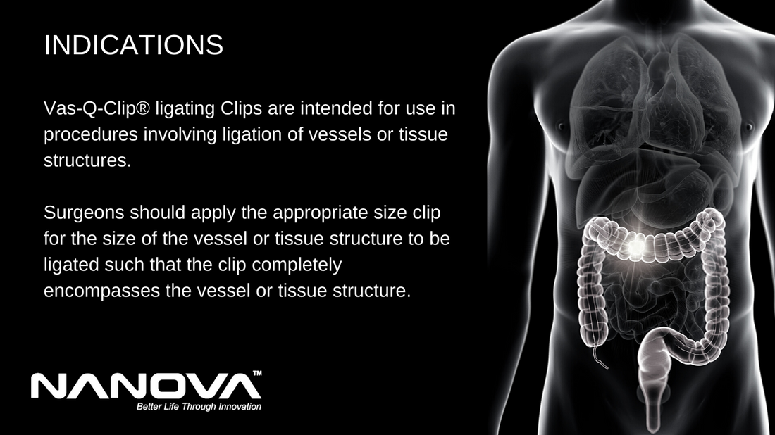 Clinical Benefits | Vas-Q-Clip® Surgical Application